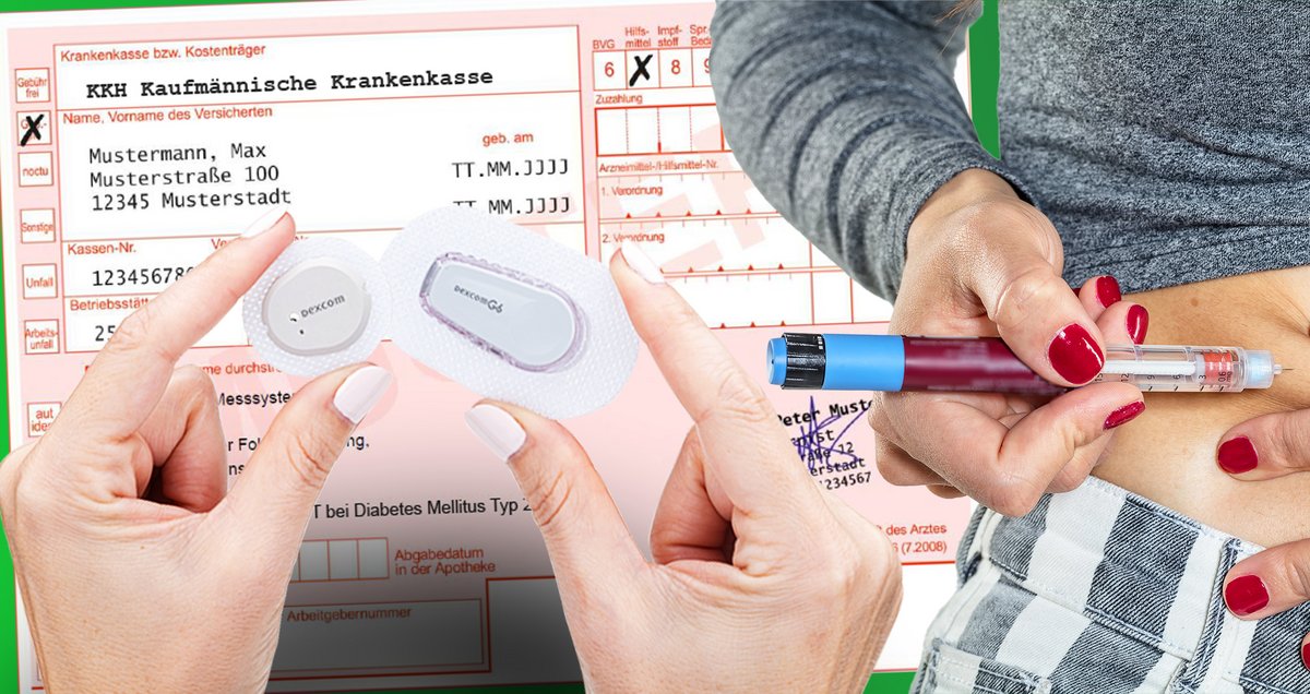 Versicherte haben die Wahl: KKH übernimmt auch Dexcom-rtCGM bei BOT ...